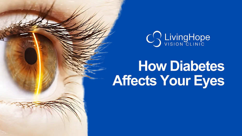 The Link Between Diabetes and Eye Health: What You Need to Know Diabetes