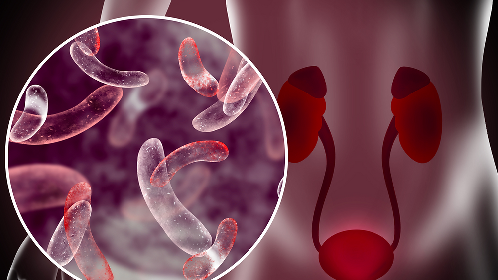 Cystoscopy: A Patient's Guide