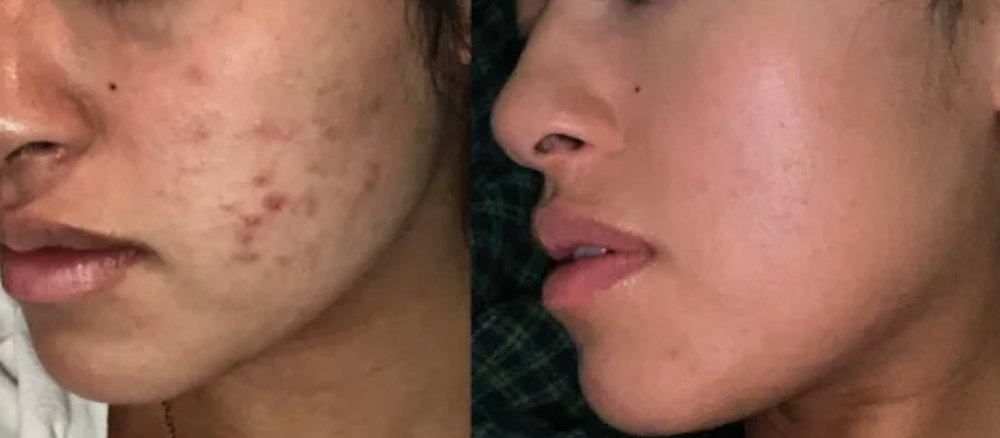 The Carnivore Diet: Balancing Hormones with Regenerative Beef