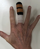 Distal Phalanx Injuries | Upper Limb QLD