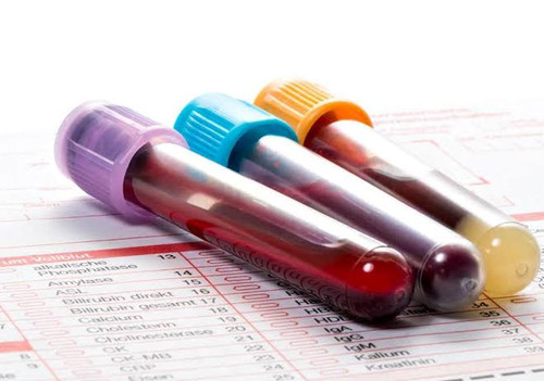 Executive Pathology Panel | Inspire Wellness