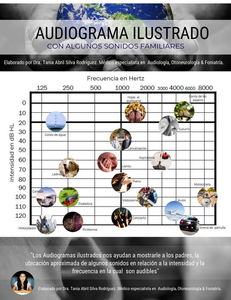 AUDIOGRAMA ILUSTRADO 1