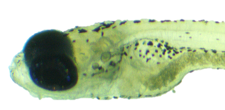 Phenylketonuria Zebrafish Model