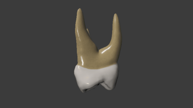 Primary Maxillary Second Molar