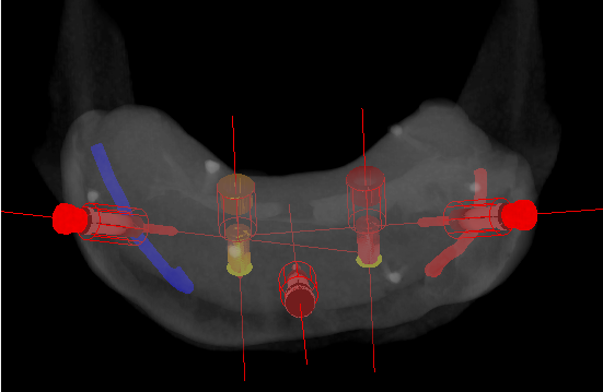 Home | Implanter SRL