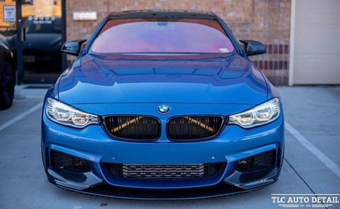 Gallery | UltraVision