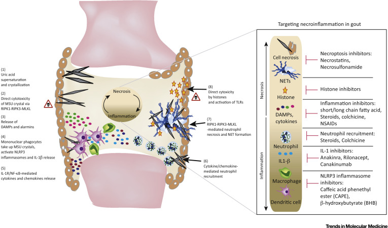 Crystal Hands: Understanding Gout and CPPD