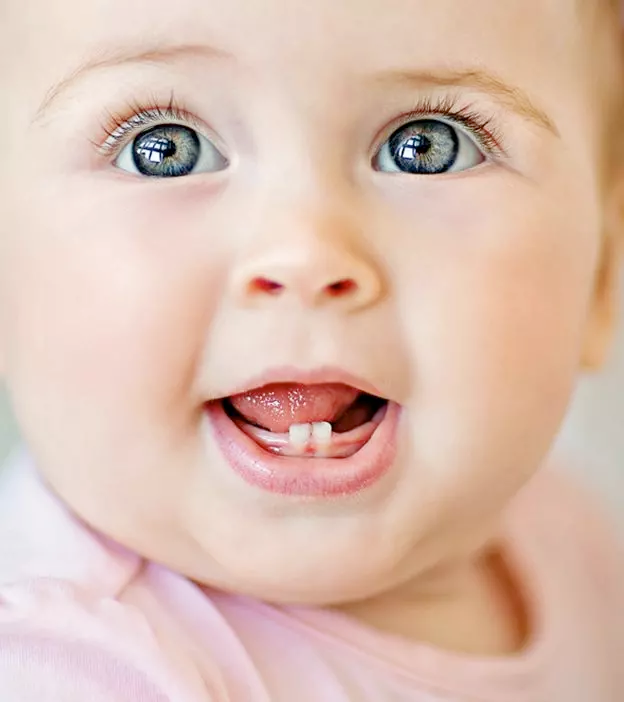 Crooked Teeth In Babies: Causes And Tips To Prevent It