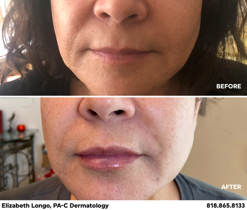 BLOG | elizabethlongoderm