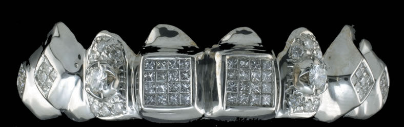 Chicago Custom Gold Teeth Grillz by ChiGrillz