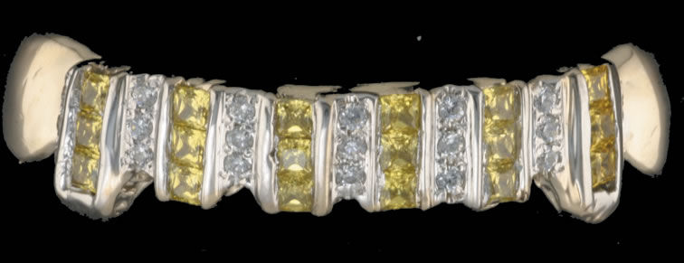 Chicago Custom Gold Teeth Grillz by ChiGrillz