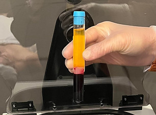 PRP Injections | FACE MedicalBoutique