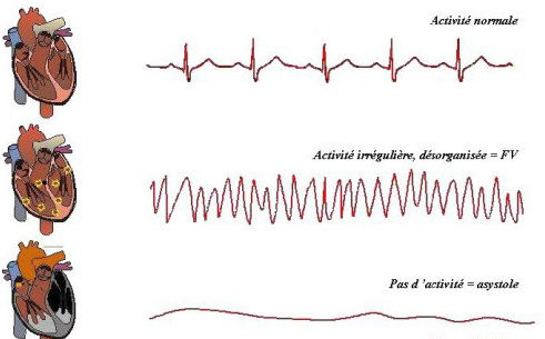 Expérience électrocardiogramme