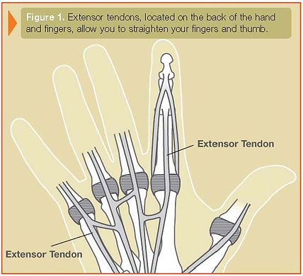 Extensor Tendon Injuries | orthohandsurgery