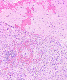 East Coast Pathology of Florida, P.A.