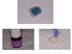 How to use Variolink Veneer, a Total-Etch Resin Cement