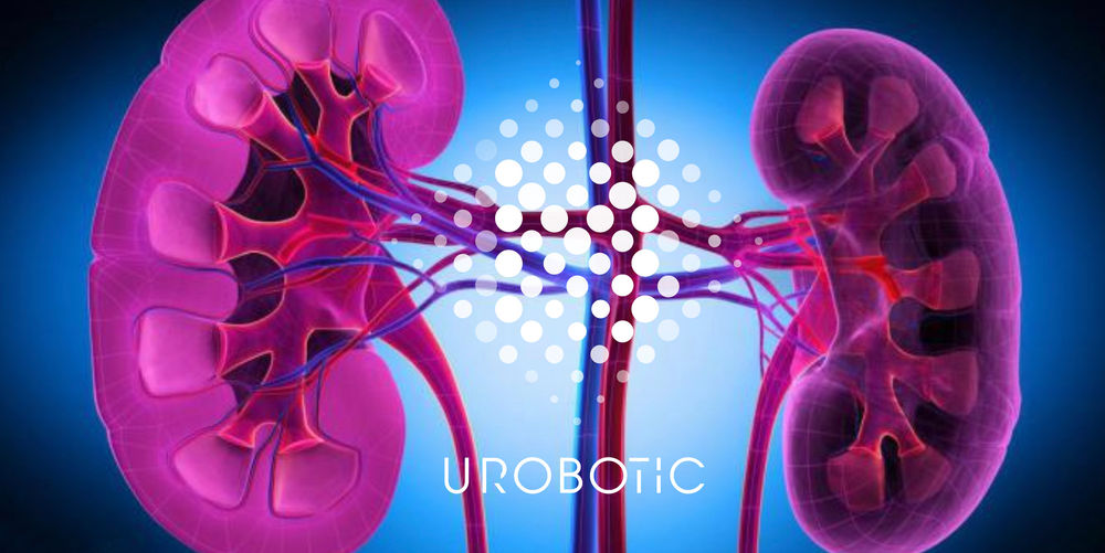 Les calculs rénaux (lithiase rénale)