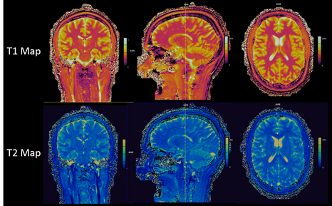 Home | Ma Lab for qMRI