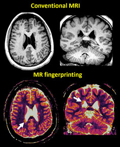 Home | Ma Lab for qMRI