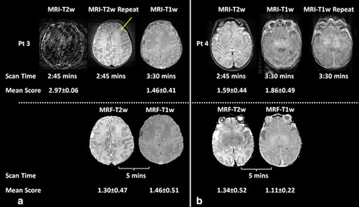 Home | Ma Lab for qMRI