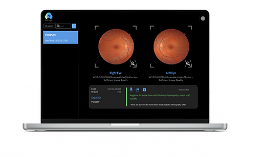 AEYE Diagnostic Screening | AEYE Health
