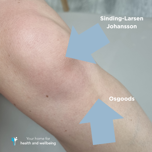 How to spot potential injuries in sporty and active children