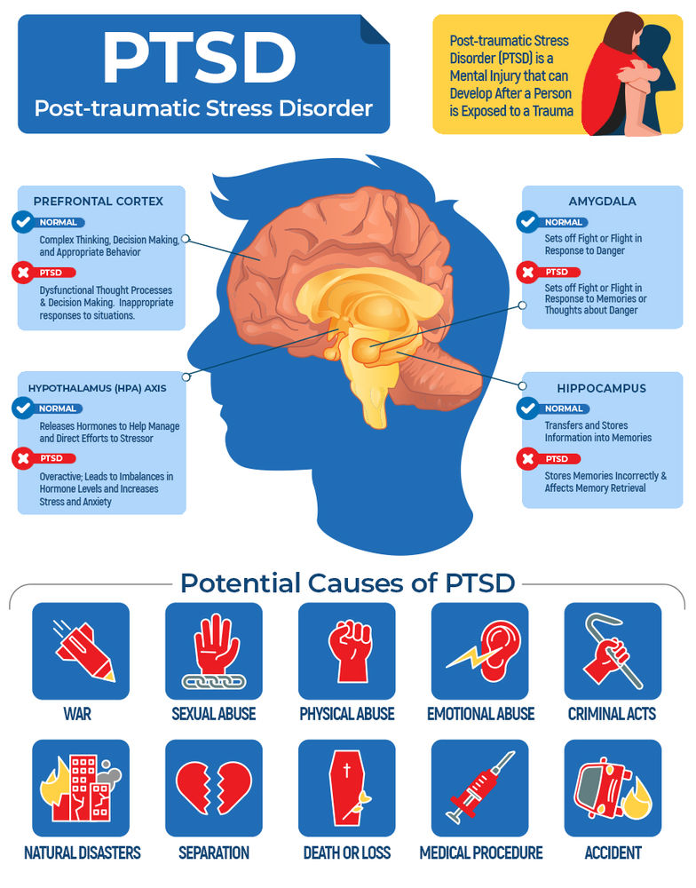 Do I Have PTSD?
