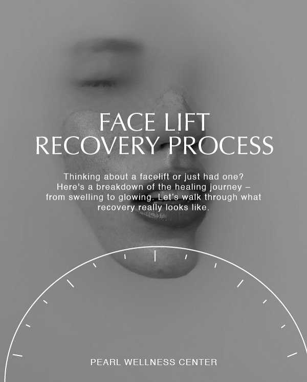 Facelift Recovery: Timeline, Day 1, & What to Expect After Surgery