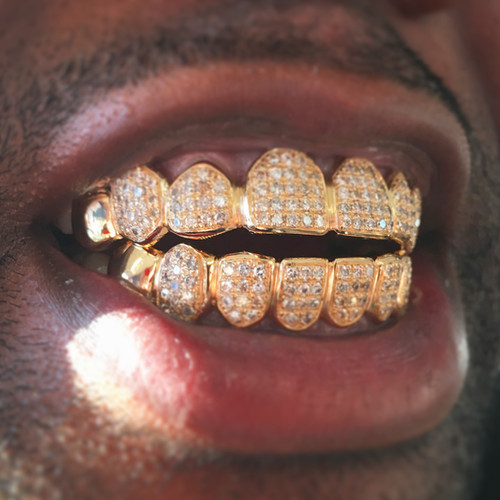 14k 8T&8B with diamond (come to the store better deal available | The ...