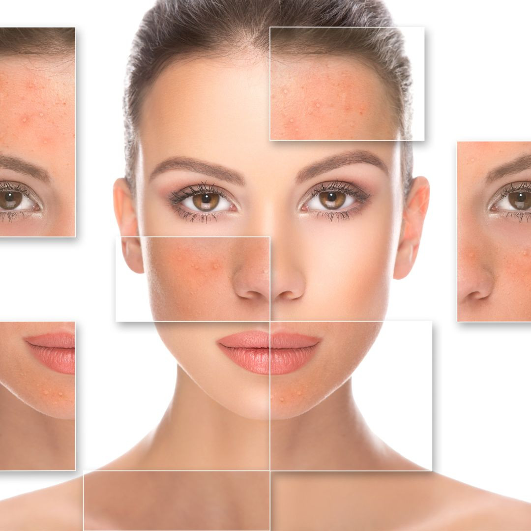 Medical Skin Procedures and Treatments in Dunedin | Advanced Skincare ...