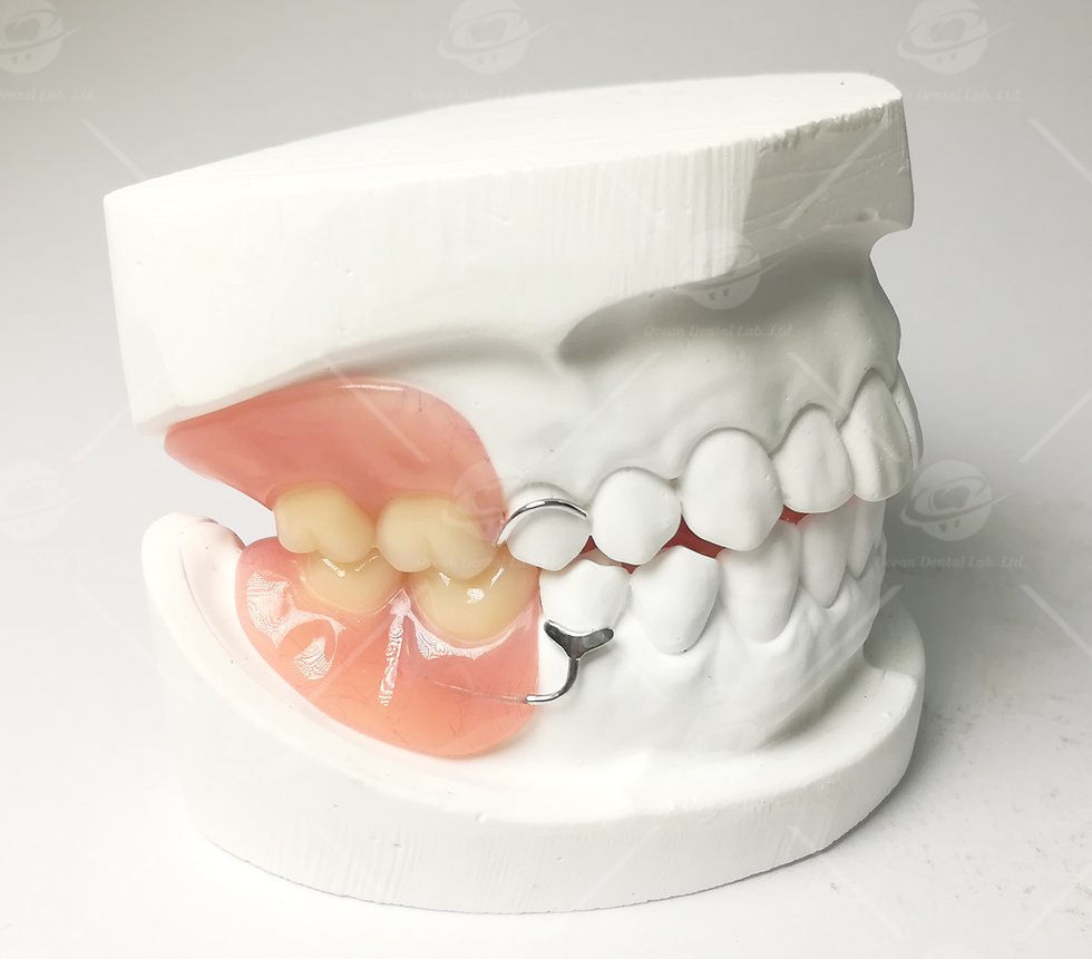 Removable Denture | ocean-dental-lab