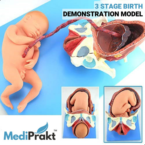 3 STAGE BIRTH DEMONSTRATION MODEL| MediPrakt