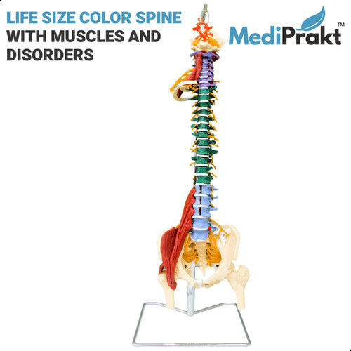 LIFE SIZE COLOR SPINE MODEL WITH MUSCLES and DISORDERS| MediPrakt