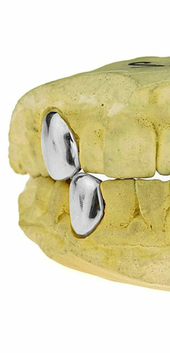 Silver single tooth cap | M.Y