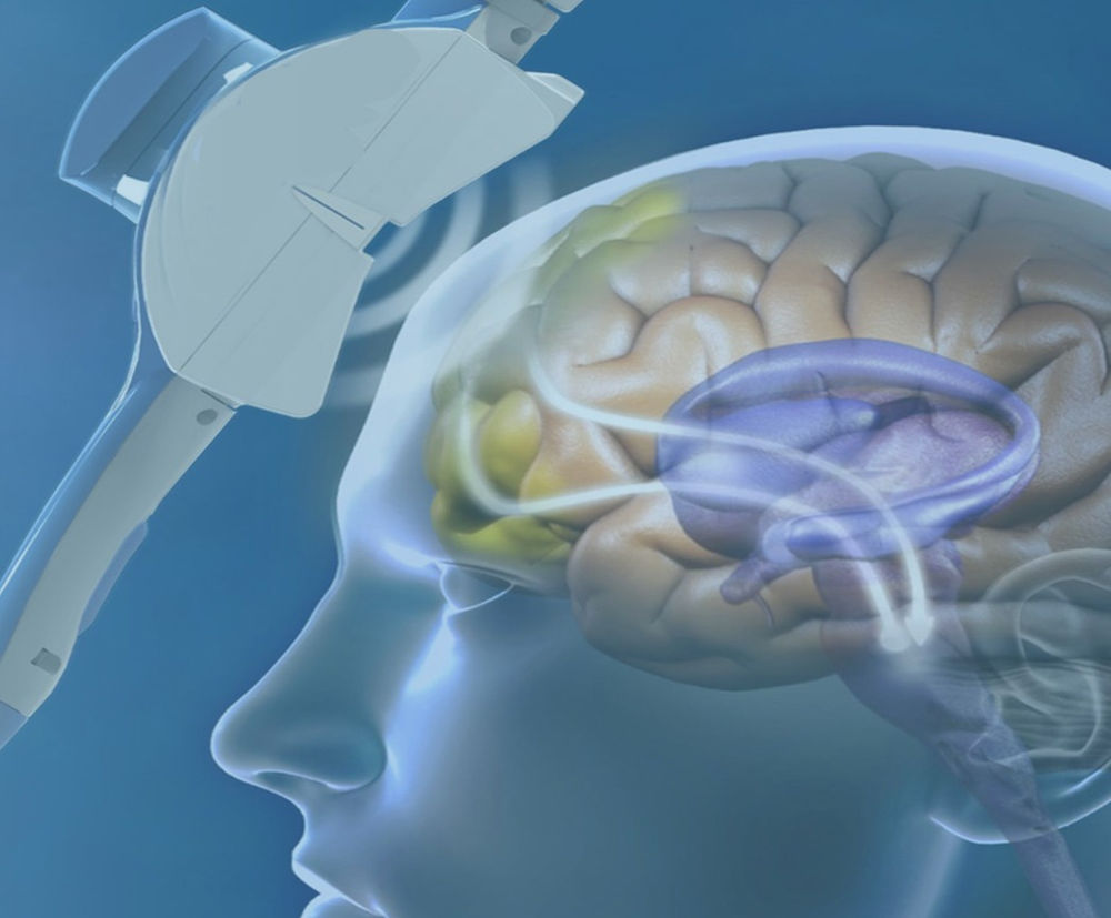 Transcranial Magnetic Stimulation: An Effective Noninvasive Therapy
