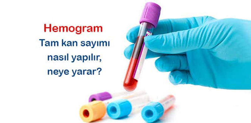 Hemogram Testi, Hemogram Testi Nasıl Yapılır, Hemogram Testi Nedir?