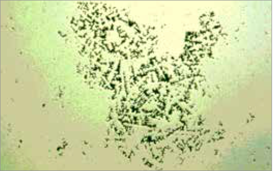 Common casting defects: what causes them?