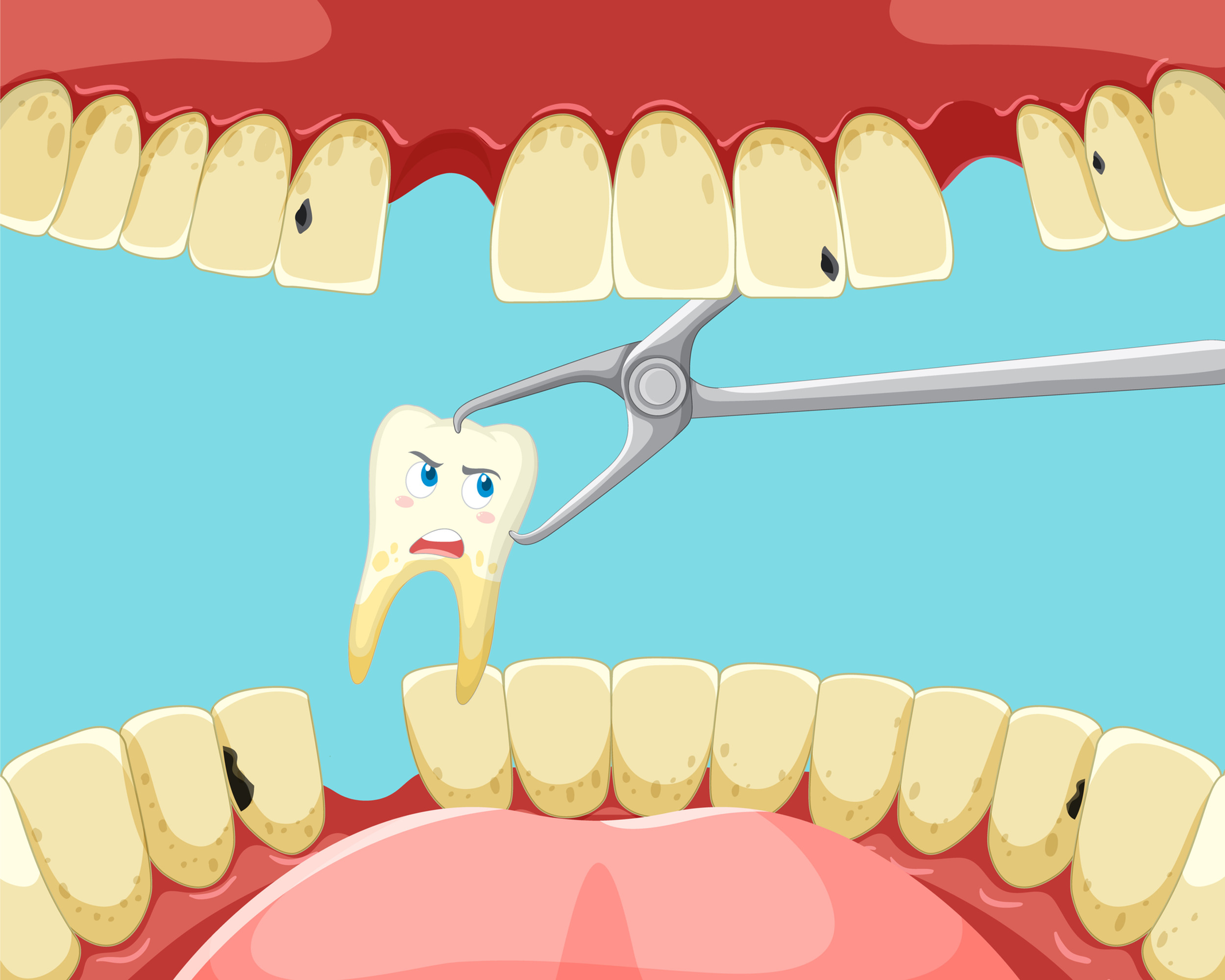 Dental Plaque: A Comprehensive Guide | Ur Smile Dental