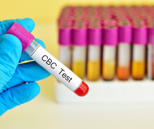 CBC w/Diff - 6399 | Acutrition