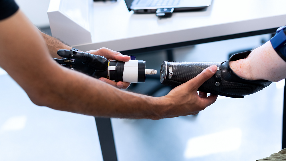Prosthetic Arm Types: Finding the Right Fit