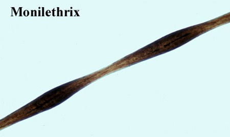 Las alteraciones estructurales del cabello