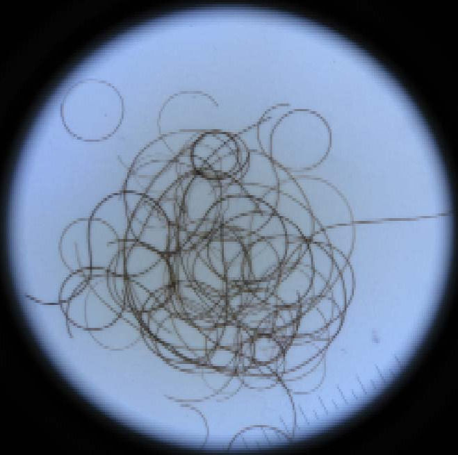 Las alteraciones estructurales del cabello
