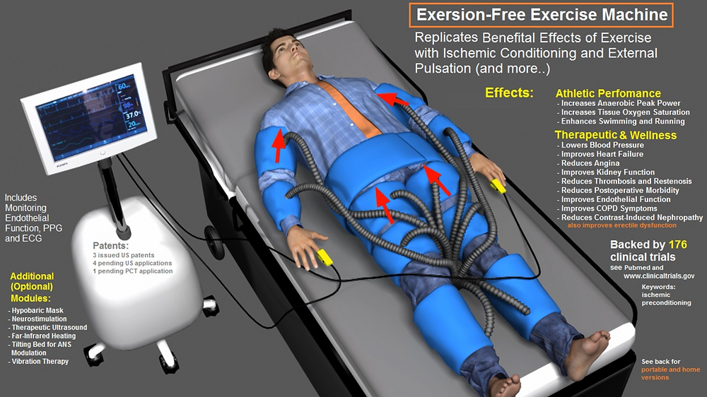 External counterpulsation stimulation combined with acupuncture for ...