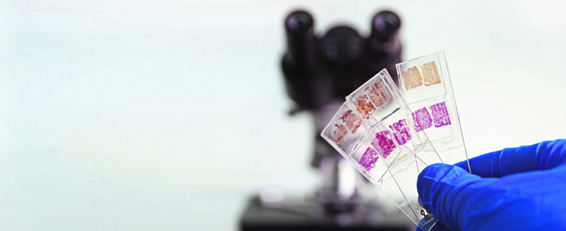 ENTENDA O EXAME DE BIÓPSIA | Para que serve e como é feita.