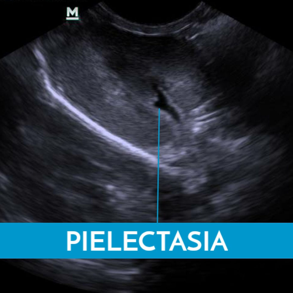 a piometra e o ultrassom - aula post