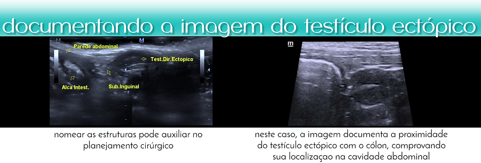 detalhes sobre os testículos ectópicos