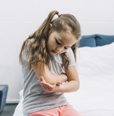 Children Affected by Scabies: Diagnosis, Treatment, and Prevention