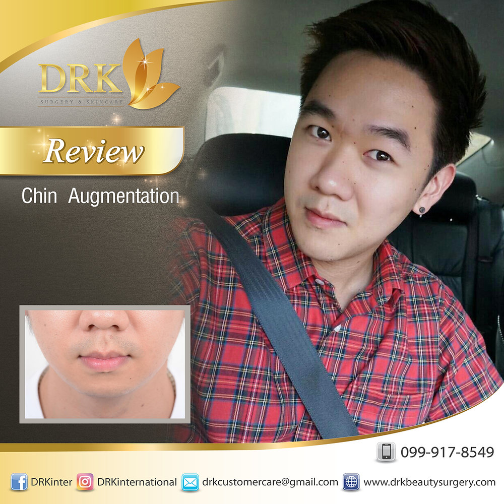 Prominent Chin for Men by Dr. Aui