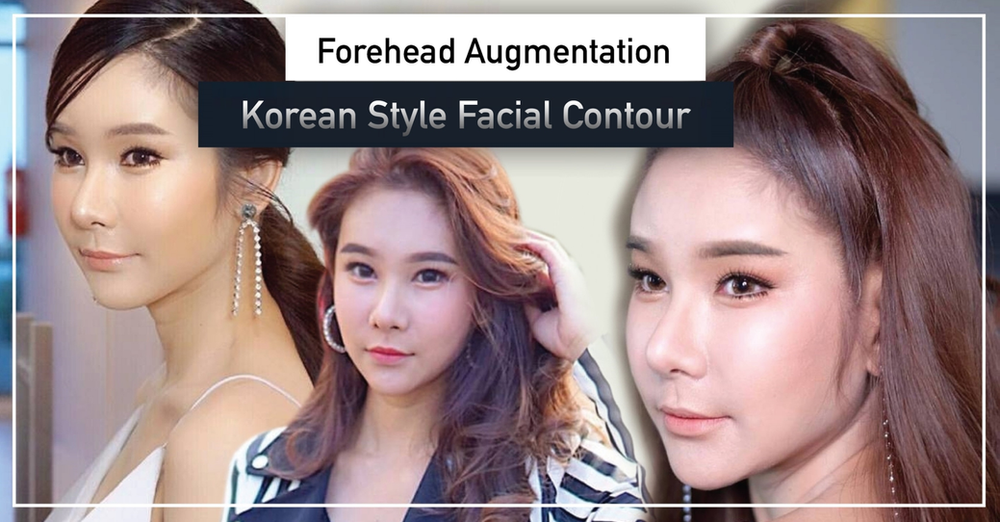 Symmetric Facial Balance Korean Style Contour through Forehead Augmentation