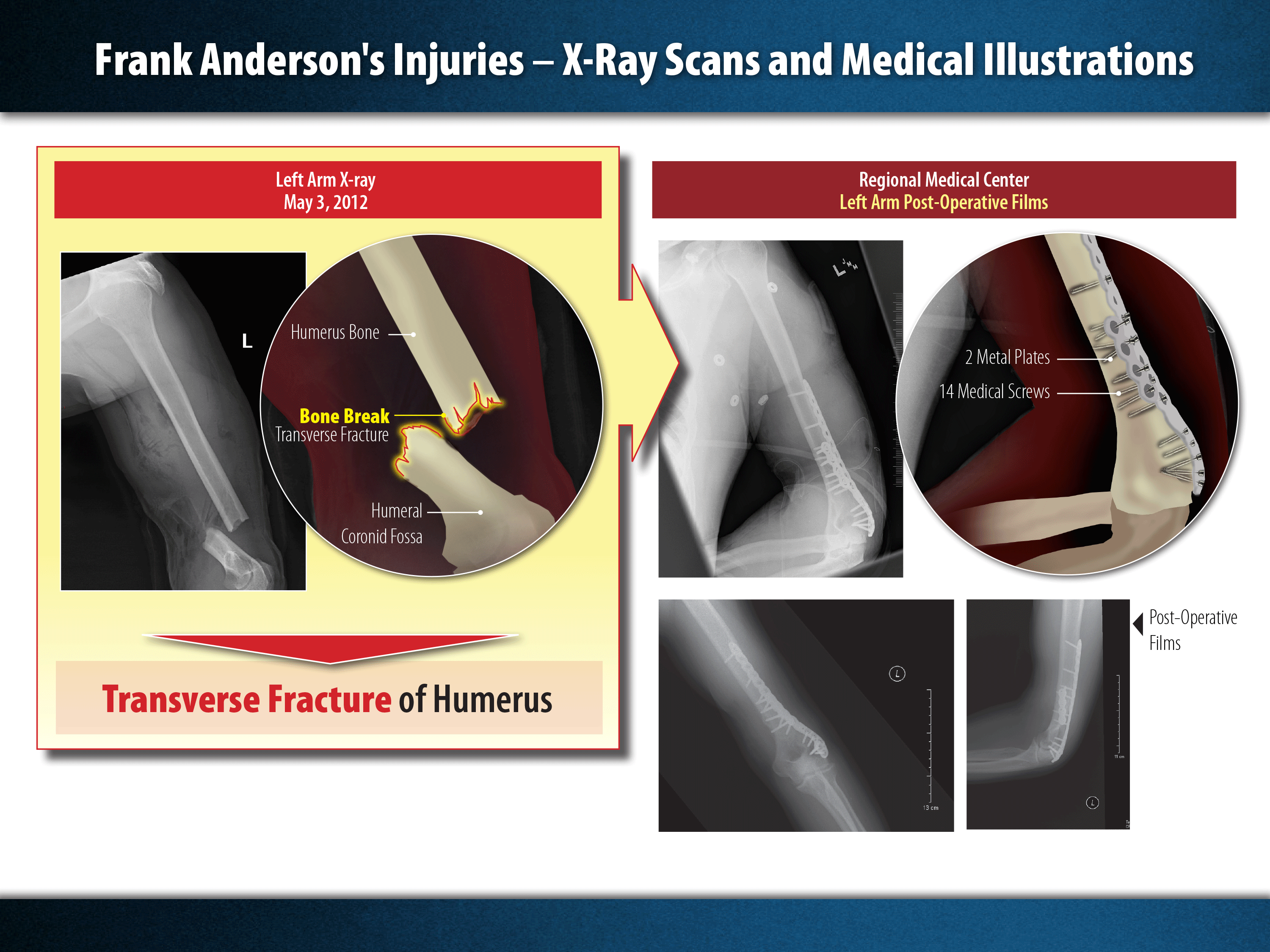 Trial Graphics | TrialSpectrum